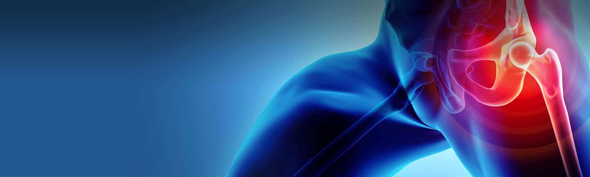 What You Should Know About Medical Device-Related Infections | ID Care